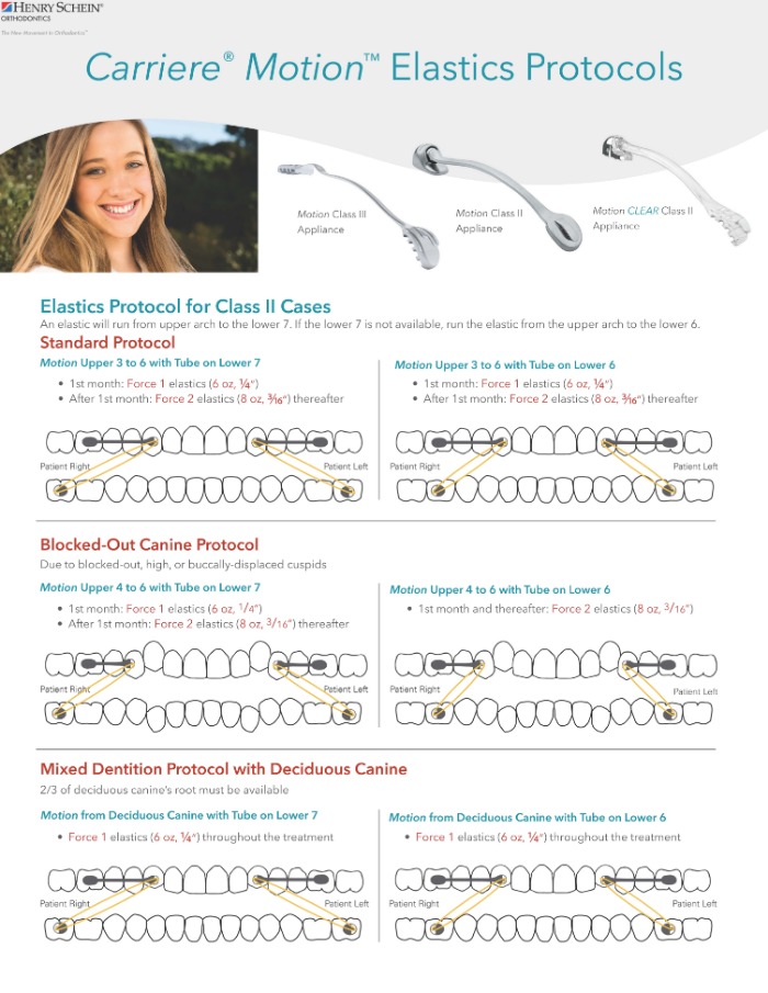 貝斯特專業矯正牙材及矯正技工